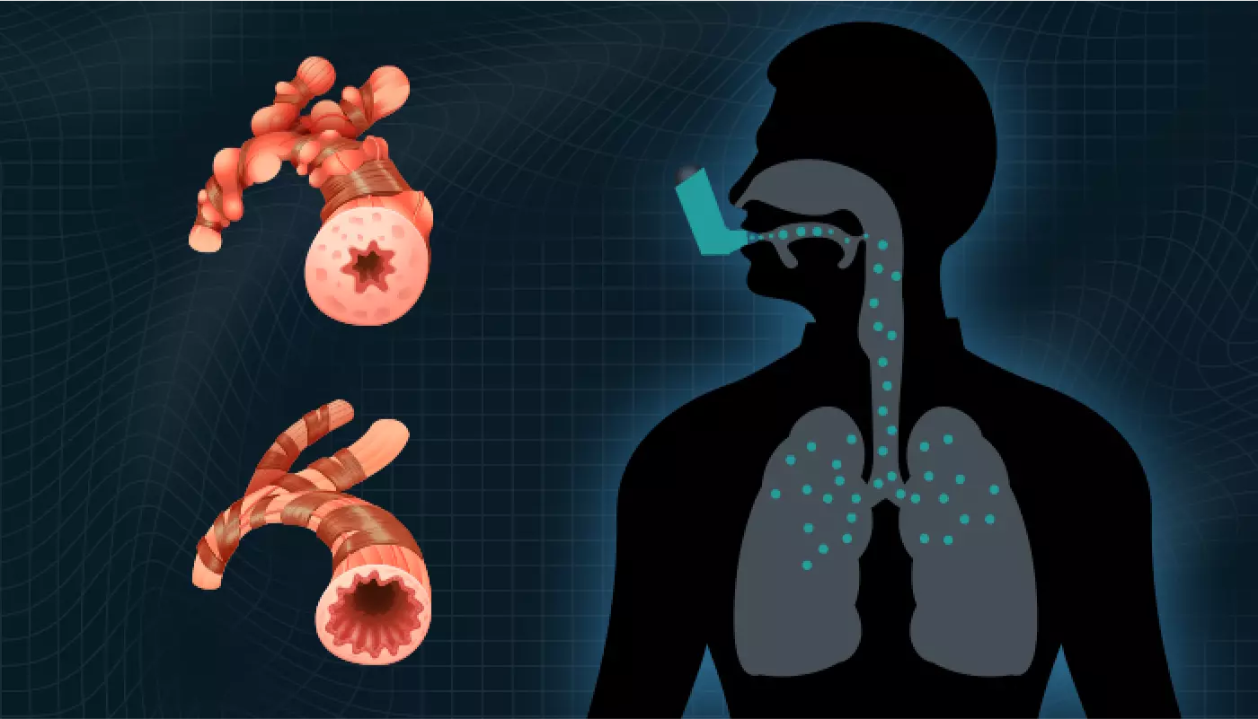 WellnessWise - RespiraFix