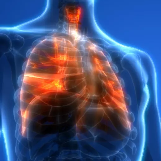 WellnessWise - RespiraFix